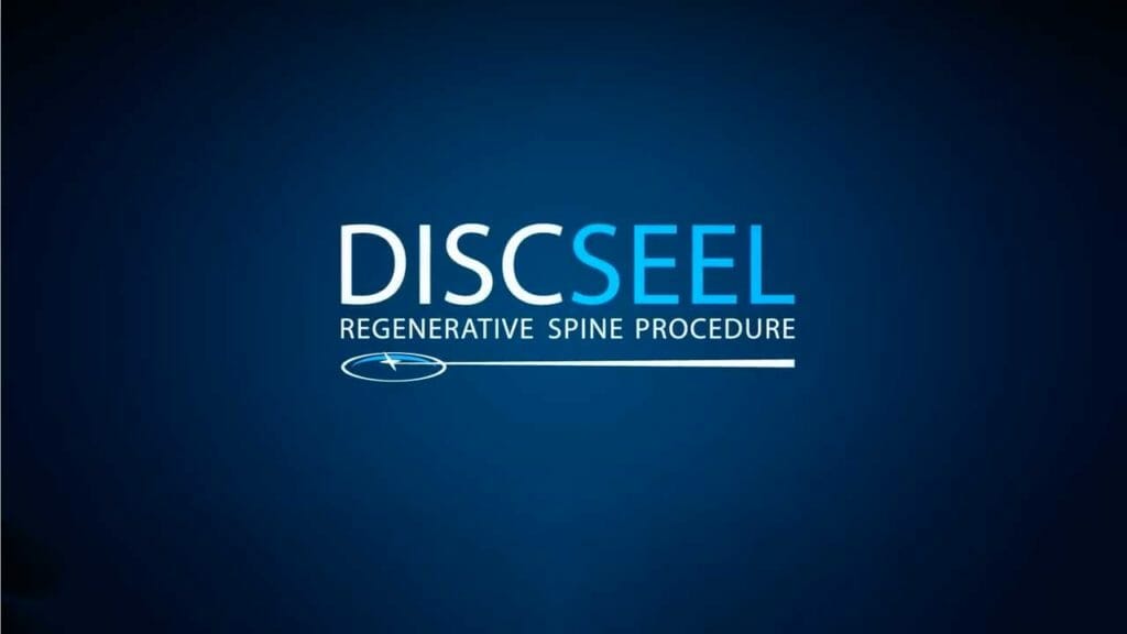 The Discseel Procedure for Back Pain and Lower Back Pain