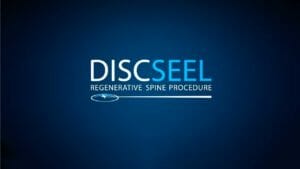 The Discseel Procedure for Back Pain and Lower Back Pain