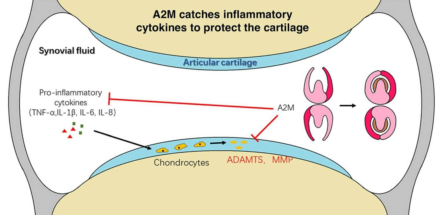Alpha-2-Macroglobulin (A2M) Injections