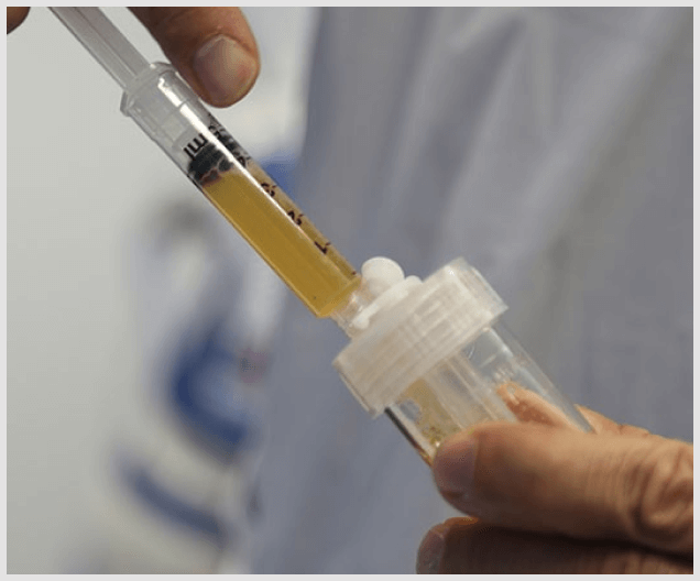 Platelet Lysate Is Made From Your Own Platelet Rich Plasma.